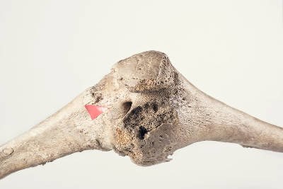 Paleopathology Collection — English